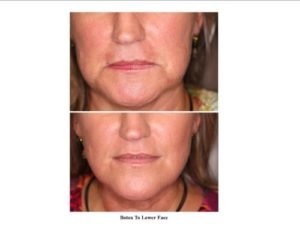 Botox to DAO « Dignity Medical